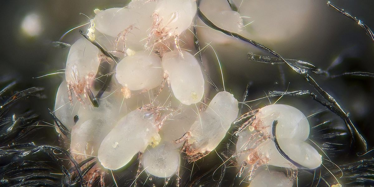 Hausstaubmilben-Allergene kapern angeborenen Immunmechanismus - Mensch ...