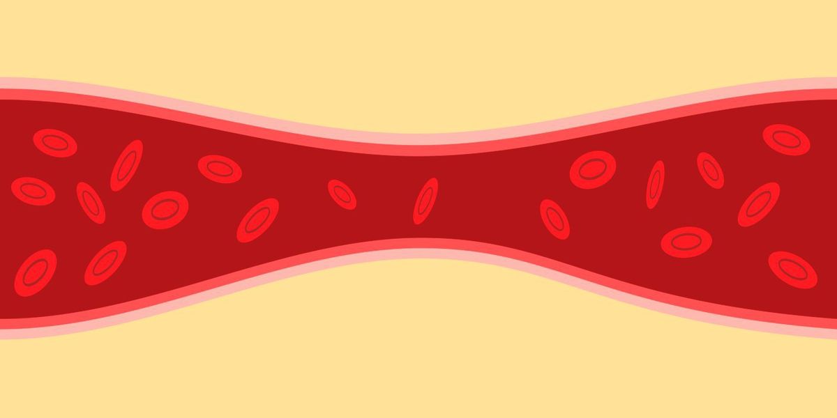 Thrombosen bei Krebspatienten besser vorhersagen - Gesundheit ...