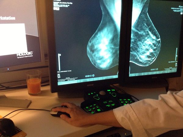 Tomosynthese: Wie eine Mammografie in 3D - Erkrankungen & Therapie ...