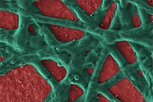 Algenprotein hilft bei der Wasserstoff-Erzeugung - Technik ...