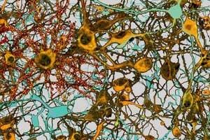 Effizienteres Lernen für Neurocomputer - Innovationen - derStandard.at ...