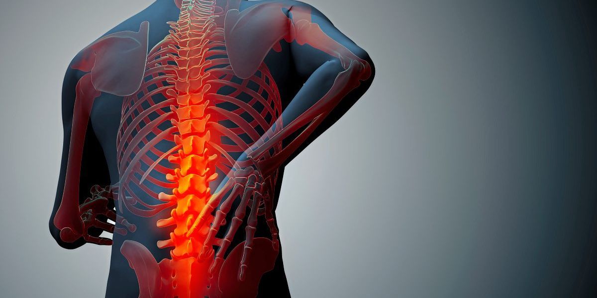 Diagnose CMD: Wenn der Rücken Zahnschmerzen bereitet – und umgekehrt ...