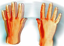 Tremor: Nichtinvasive Technik mit Ultraschall lindert Symptome ...