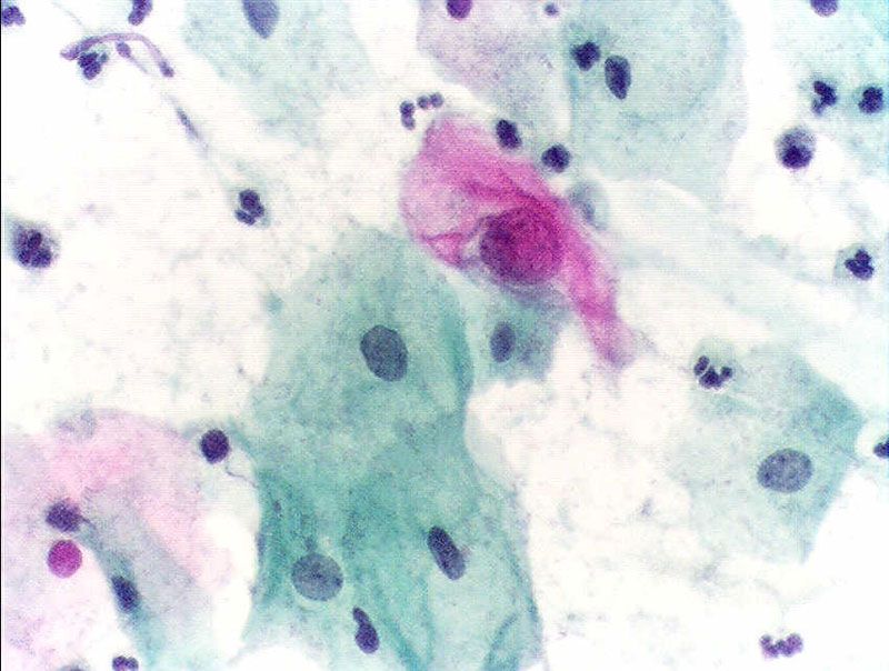 Pathologie für Lebende auf dem Vormarsch - Erkrankungen & Therapie ...